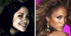 J Lo Nose Job - Before & After | Jennifer Lopez Nose Job - Deviated ...