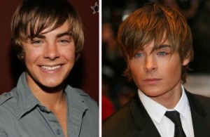 Top Ten Celebrity Nose Jobs – Men - Deviated Septum Information & Advice