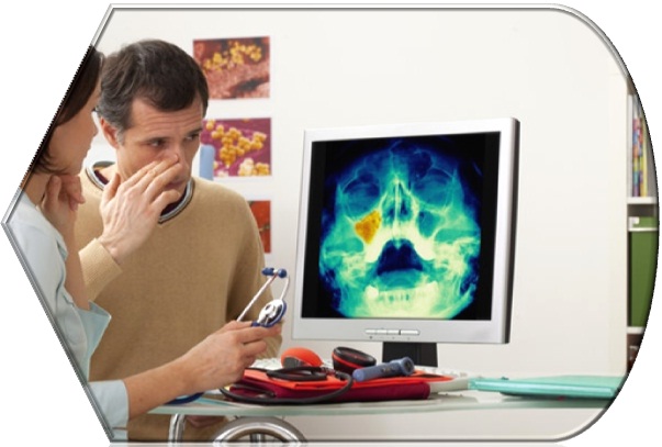 In office Balloon Sinuplasty For Deviated Septum - Deviated Septum ...